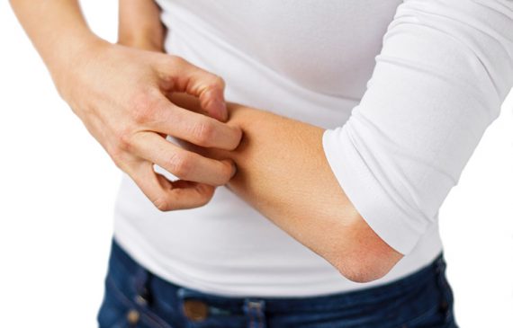 Fibromyalgia Formication: Bugs On Your Skin