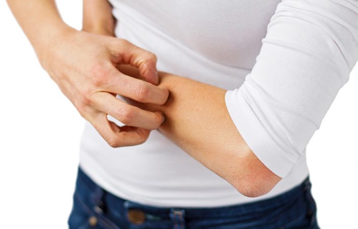 Fibromyalgia Formication: Bugs On Your Skin